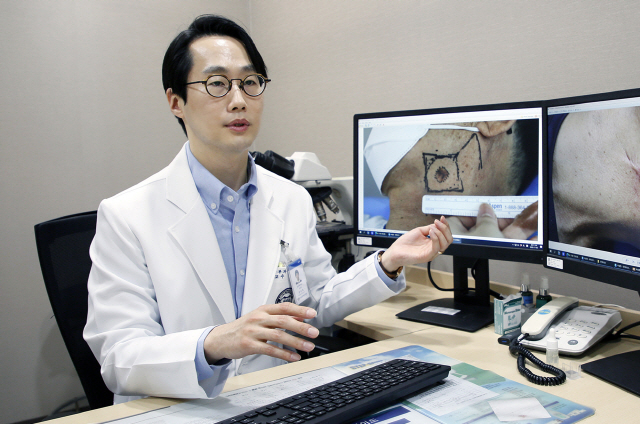 [헬스가이드 피부암] 점인줄 알았는데…최상의 예방은 자외선 노출 줄이기